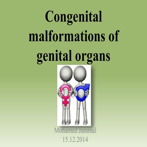 Congenital malformations of genital organs | PPTX