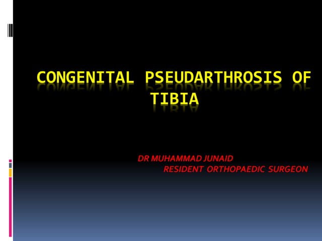Congenital pseudoarthrosis of tibia | PPTX
