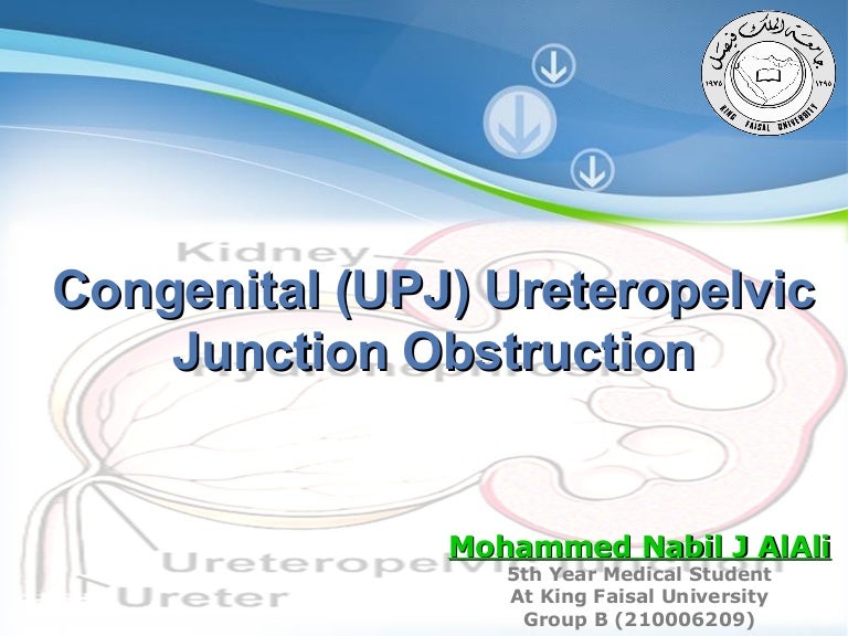 Upj Obstruction Causes Symptoms Treatment Upj Obstruction