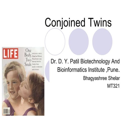 Conjoined Twins.ppt