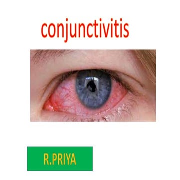Conjunctivitis | PPTX