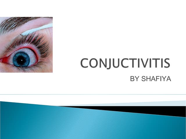 Conjunctiva Pptx