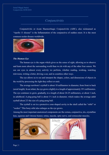 Conjunctivitis | PPT