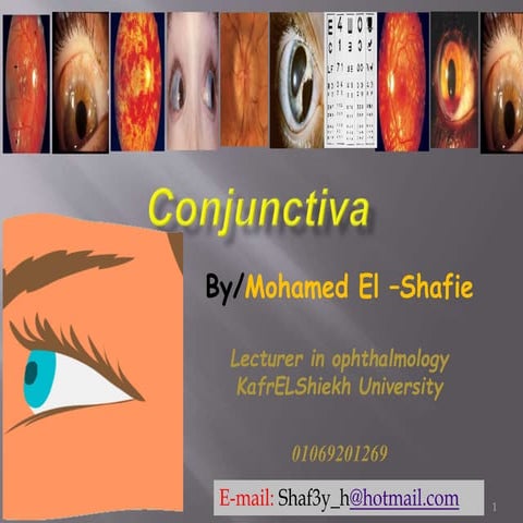 Conjunctiva integrated.pptx