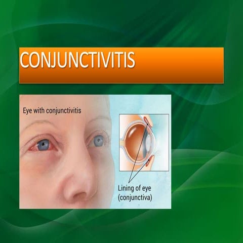 Conjunctivitis | PPTX