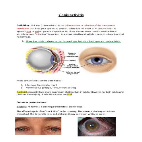 conjunctivitis.docx | Eye and Vision Conditions | Diseases and Conditions
