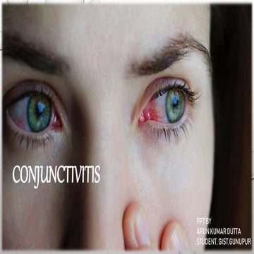 CONJUNCTIVITIS.pptx