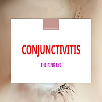 Conjunctivitis.pptx PPT | PPT