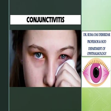Conjunctivitis types and their managemant.pptx