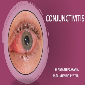 Conjunctivitis - its types, clinical manifestation and nursing management | PPTX