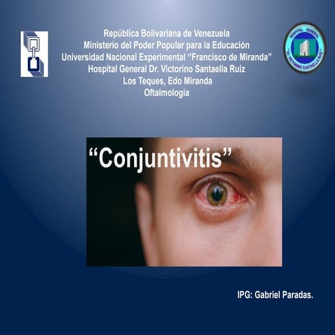 Comprehensive Overview of Conjunctivitis: Types, Causes, Diagnosis, and ...