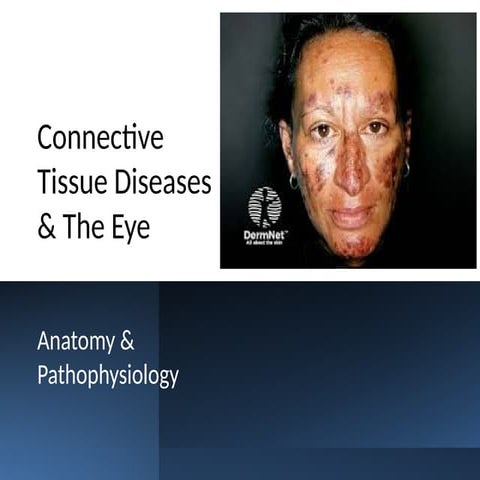 Connective_Tissue_Diseases_Preentation (1).pptx