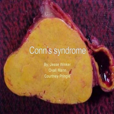Conn's Syndrome: Causes, Symptoms, and Treatment of Aldosterone ...