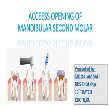 Access opening of molar teeth | PDF