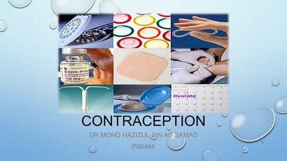 Intrauterine device (IUD) | PPTX