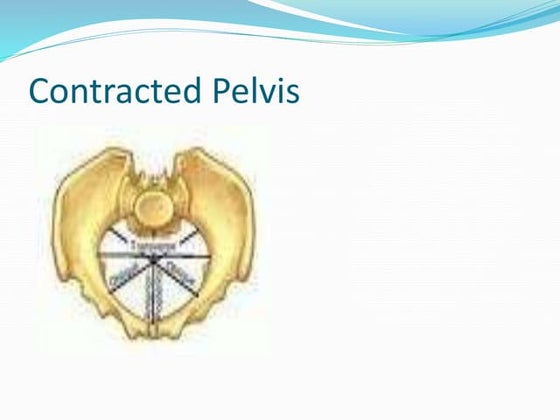 Pelvimetry | PPT