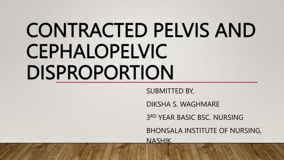 Cephalopelvic disproportion 2021 | PPT