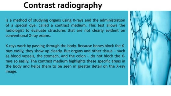 Contrast Radiography of general radiology.pptx