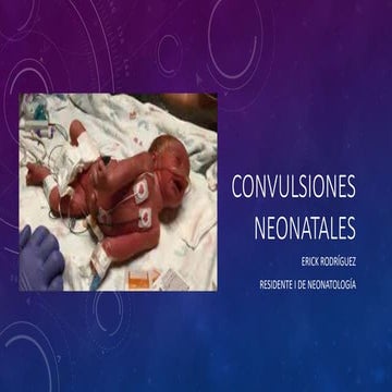 Convulsiones neonatales: factores de riesgo, diagnóstico y manejo | PPT