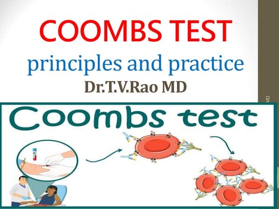 Coomb's test | PPT