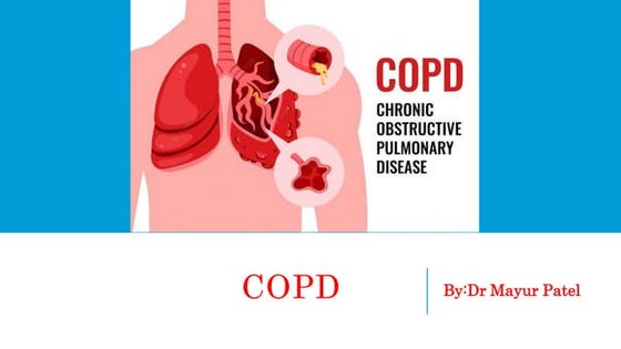 COPD -MA.pptx