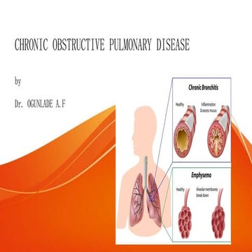 Chronic obstructive pulmonary disease | PPT
