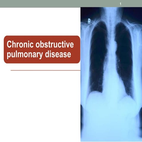 PULMONOLOGY CHRONIC OBSTRUCTIVE PULMONARY DISEASE | PPT