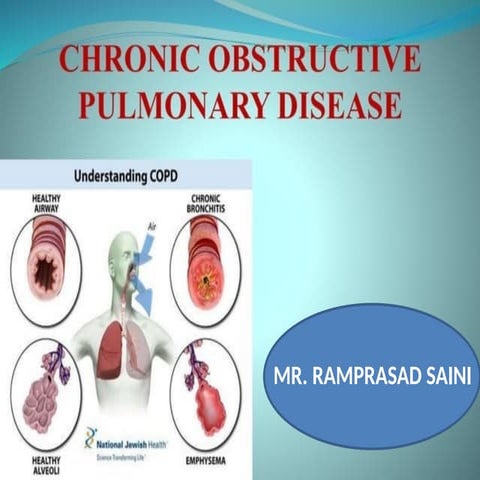 COPD COPD, or chronic obstructive pulmonary disease, is a condition ...