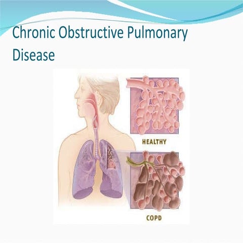 Copd 2010 | PPT