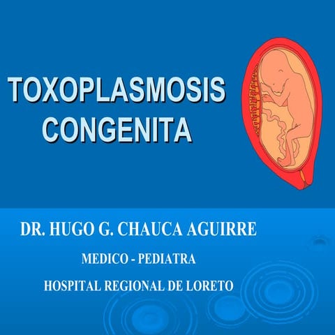 Toxoplasmosis | PPTX