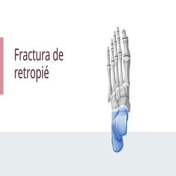 Fractura de retropié traumatología y ortopedia.pptx