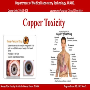 Copper toxicity.pdf