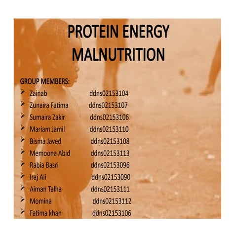 Protein energy malnutrition | PPTX