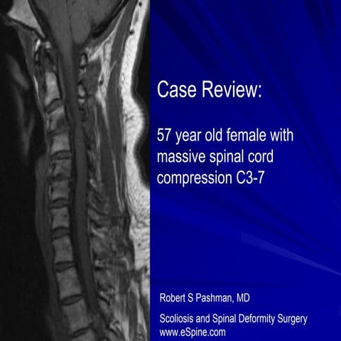 Case Review #6: 57 year old female with severe spinal cord compression ...