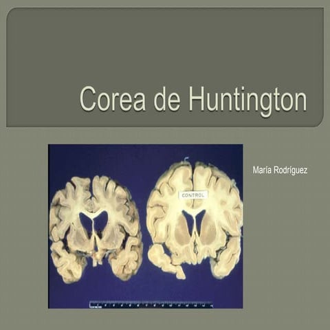 Corea de huntington. | PPTX