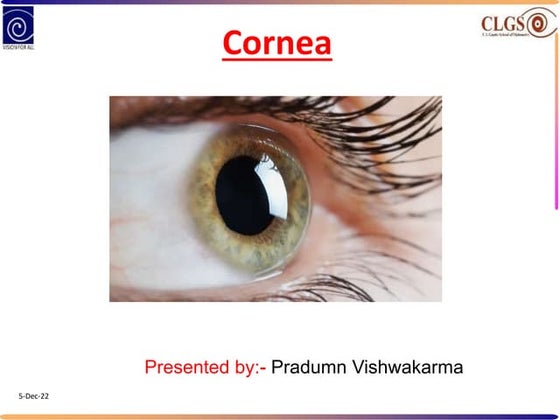 ANATOMY OF CORNEA FOR CONTACT LENS FITTING | PPT
