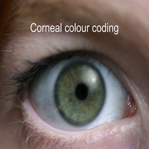 Retina drwaing | PPTX
