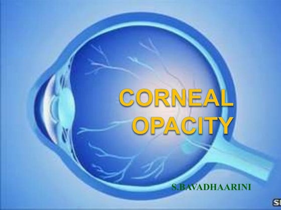 Corneal opacity | PPT
