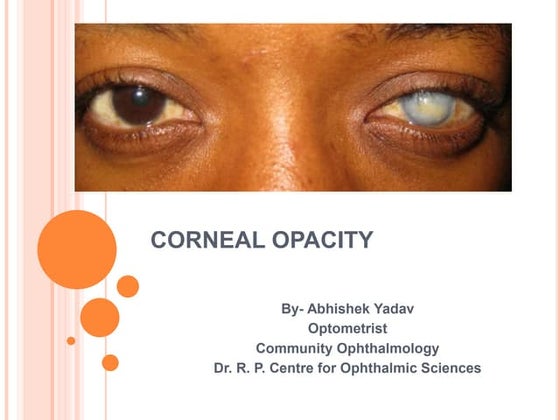 Lacrimal sac syringing | PPT