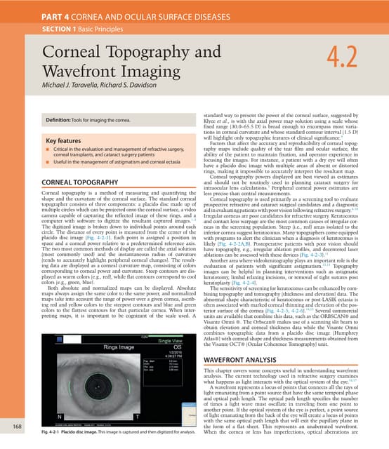 Corneal topographer - Medical Equipment | PDF | 3-D Graphics | Computer ...