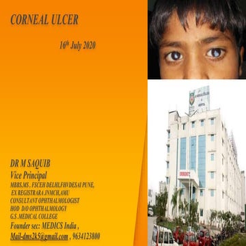 CORNEAL ULCER ,DR M SAQUIB , OPHTHALMOLOGY | PPTX