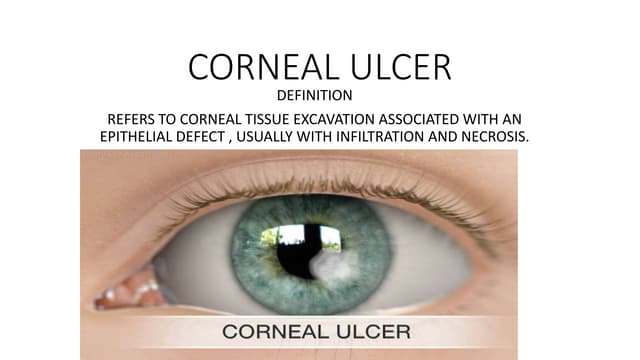 Corneal Ulcerpptx
