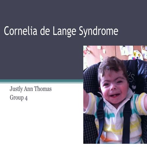 Cornelia de Lange Syndrome.pptx