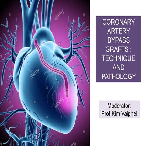 Coronary artery by pass graft | PPT