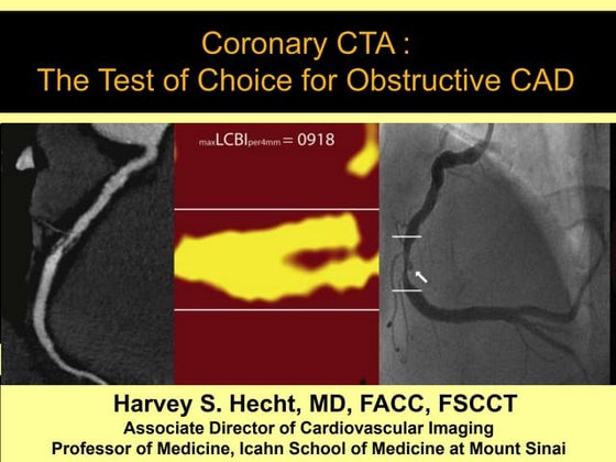 CT angiography.pptx