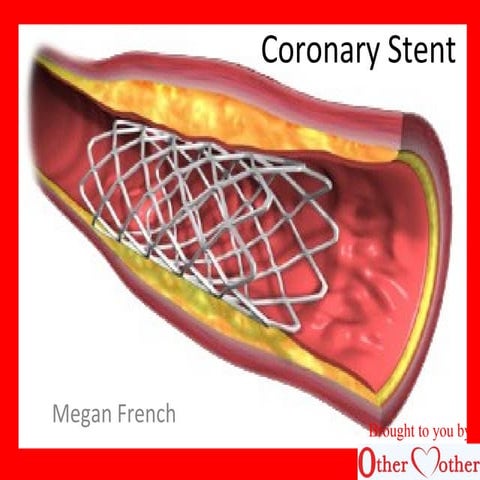 cathlab essentials.pdf