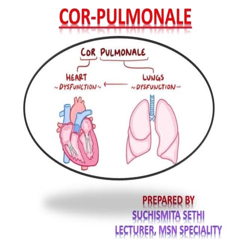 Cor pulmonaly | PPTX