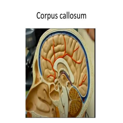 CORPUS CALLOSUM ULTRASONOGRAFİSİ DR.BAHRİ YILDIZ.pptx
