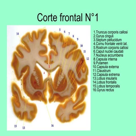 Corte coronal de encefalo | PPT