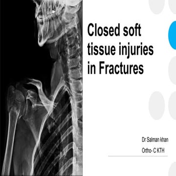 Close soft tissue injuries in fractures.pptx